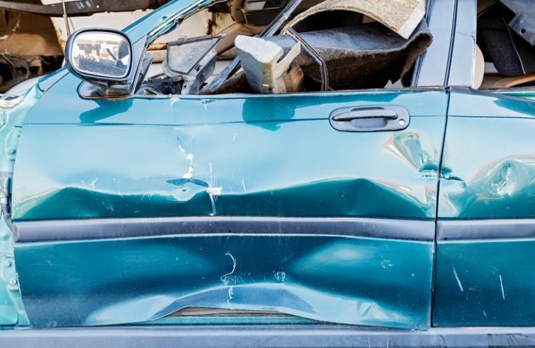 Seat Belt Injury Caused by Car Accident | Body Works Health & Wellness